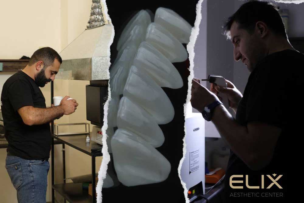 Dental laboratory in Yerevan, Armenia